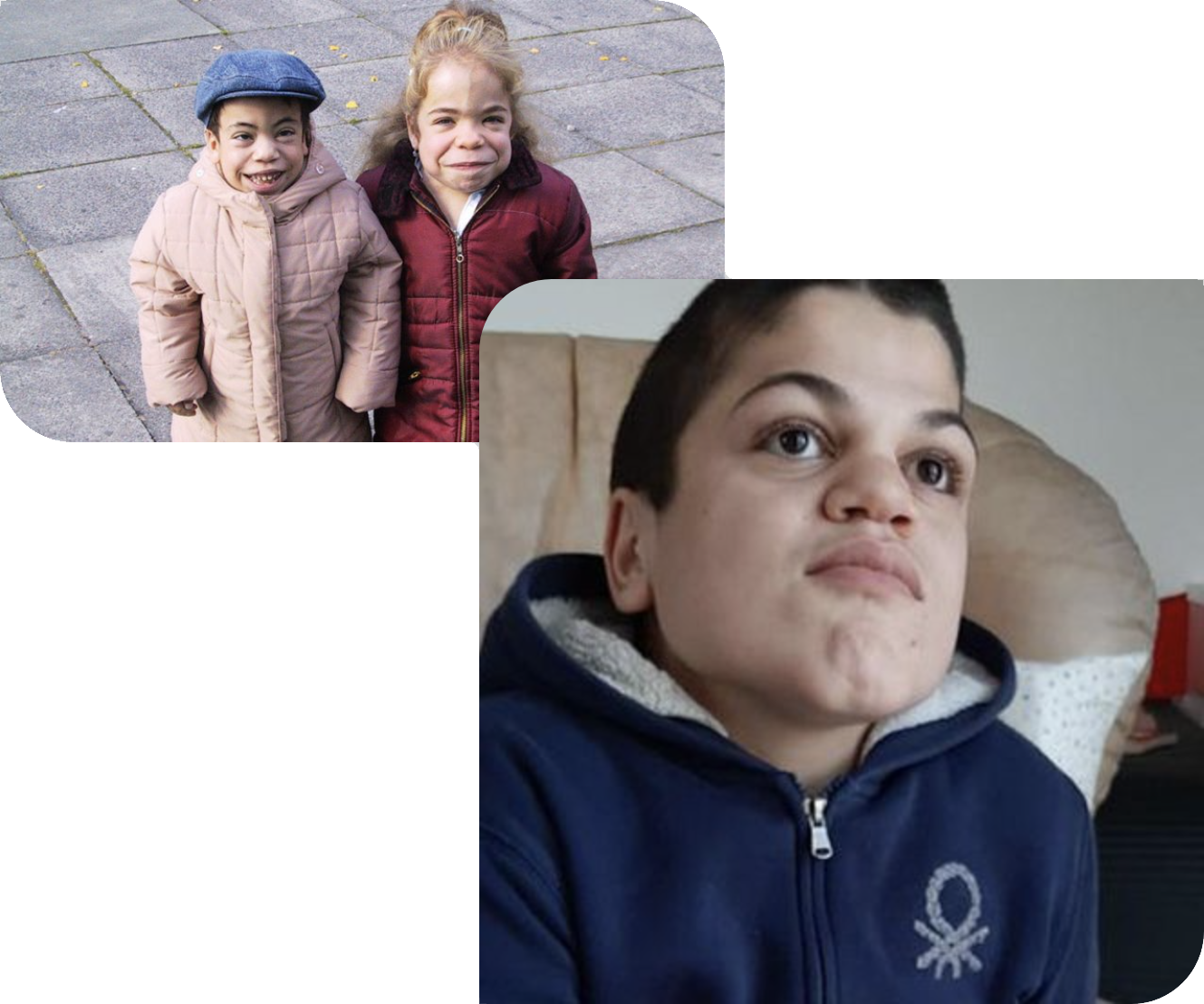 COME AIUTARCI – AIMPS – Associazione Italiana Mucopolisaccaridosi e ...